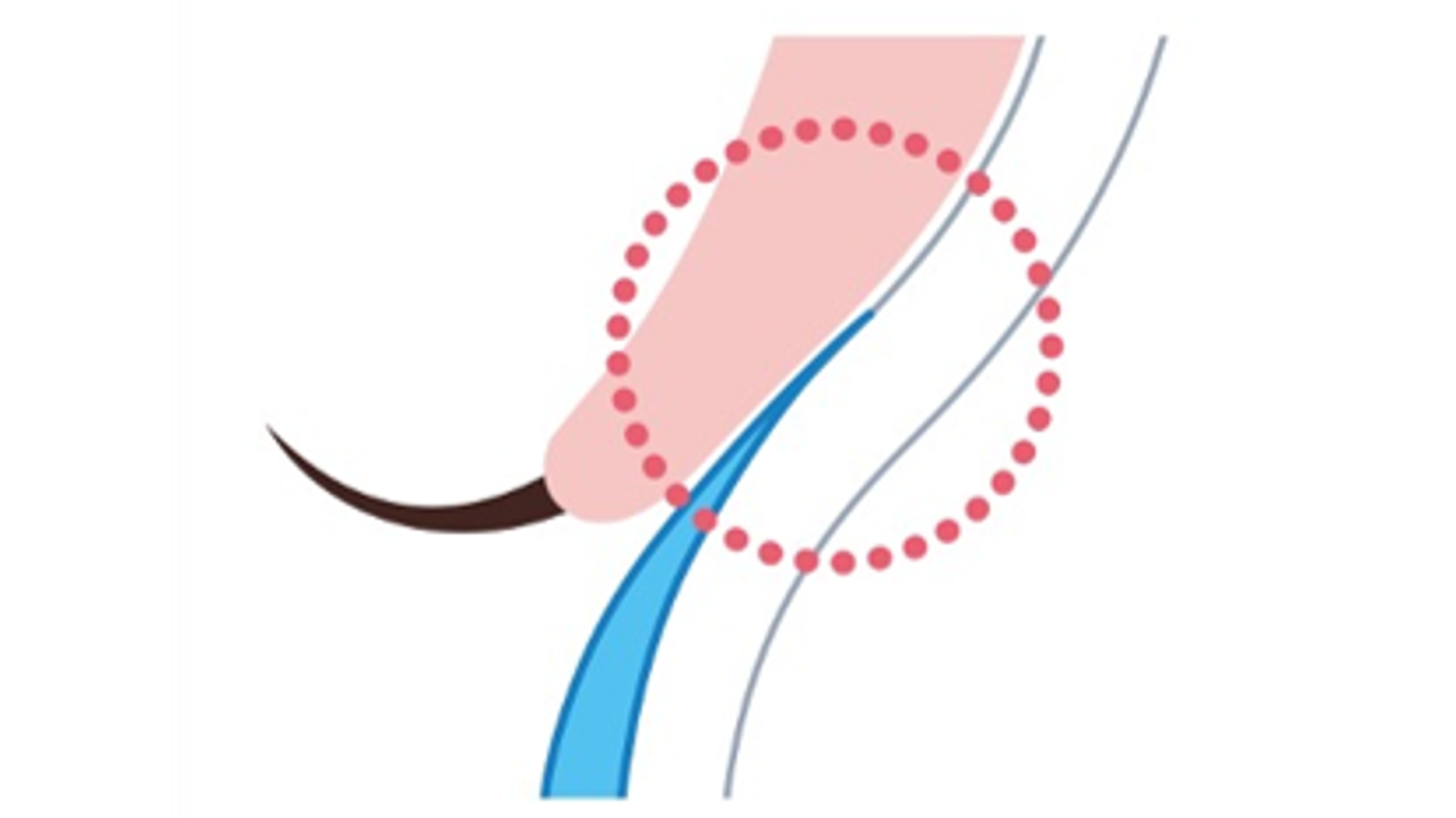 Miru 1day Flat Pack | Products | Professional | Menicon America